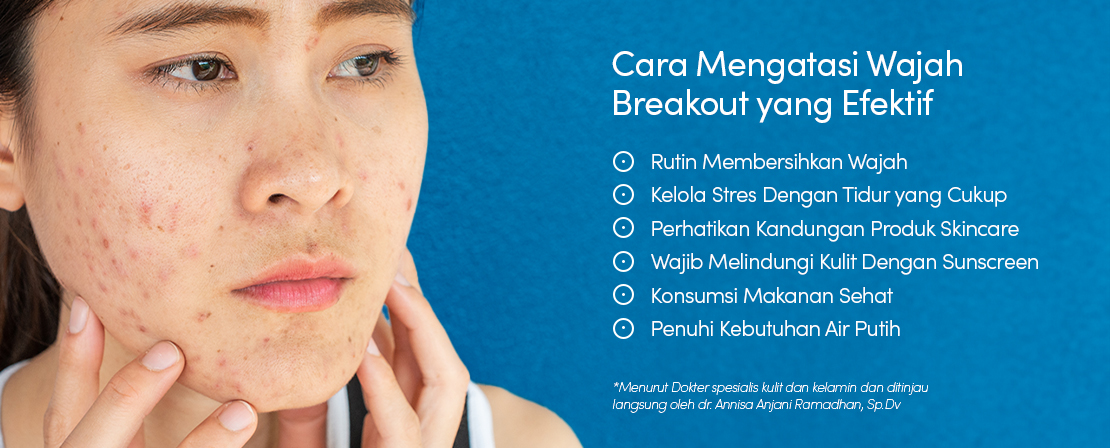 Apa itu Wajah Breakout? Ini Penyebab dan Cara Mengatasinya Menurut Expert!