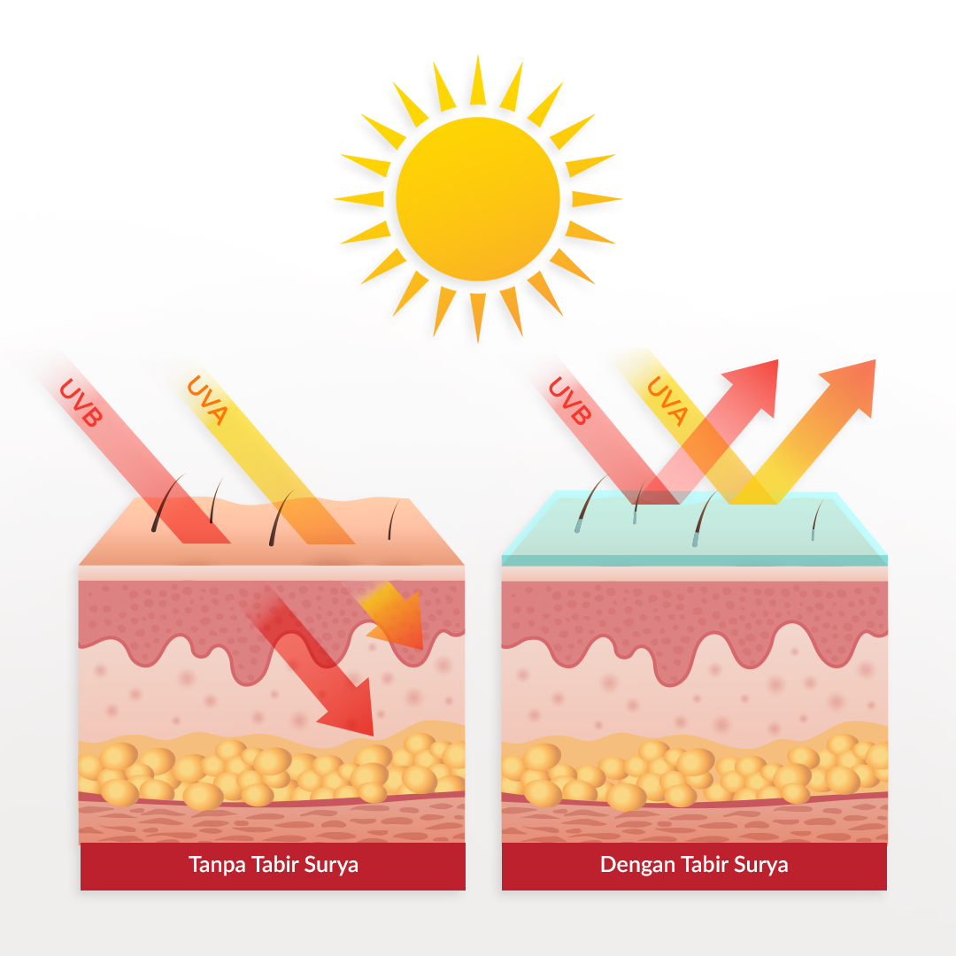 Cara Menghilangkan Belang Di Wajah Dengan Cepat & Ampuh!